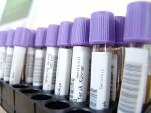 Blood Test for Blood Type and Rh Status And Antibody Screen