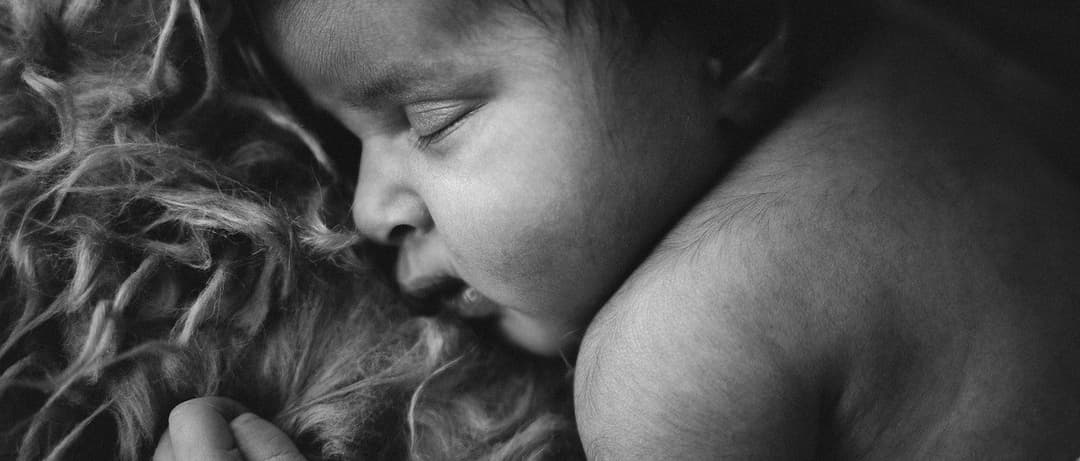 Why Do Babies Have Swollen Genitals At Birth?